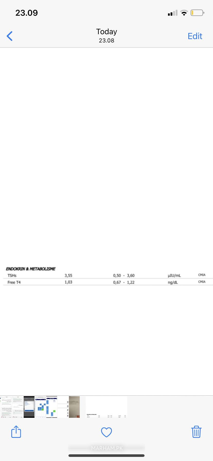 Ask a Endocrinologist Online for Hypothyroidism - Levothyroxine Doses