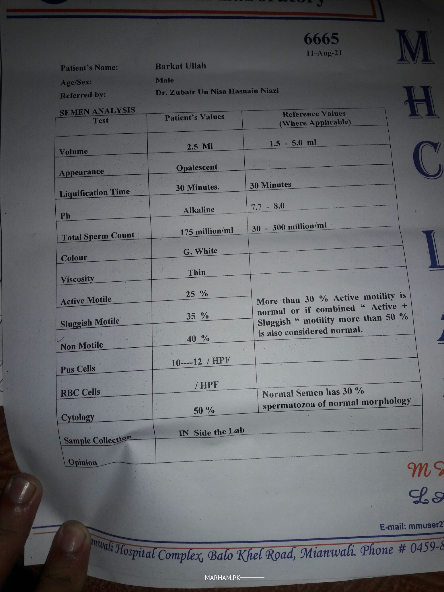 Ask a Endourologist Online for Semon Analysis