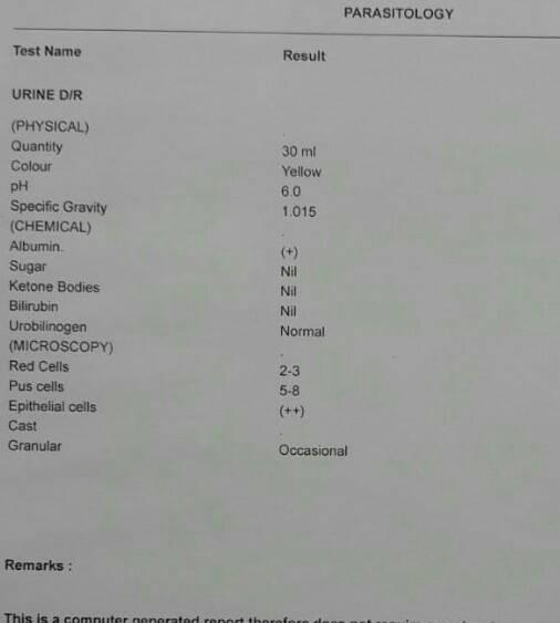 Ask a Urologist Online for Urine Track Infection