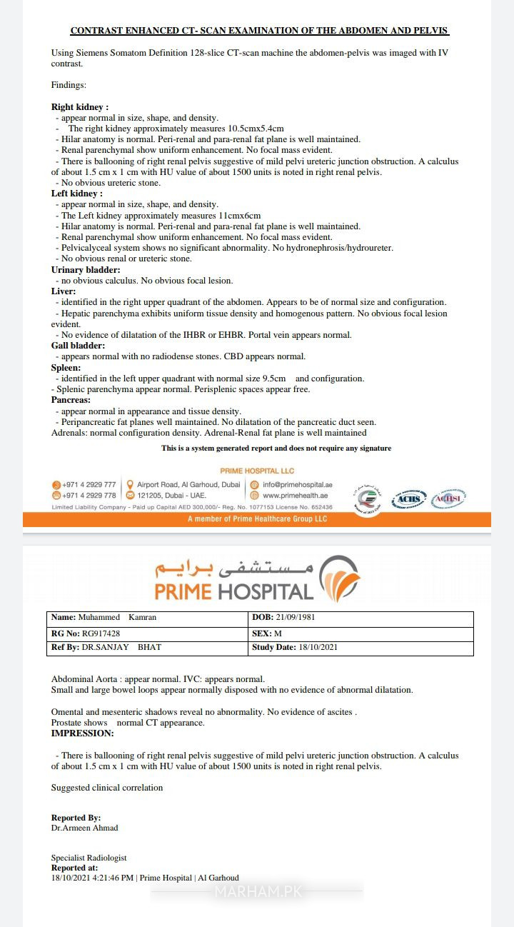 Ask a Radiologist Online for CT Scan, Kidney Stone