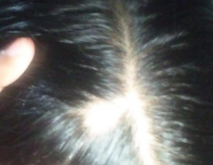 Ask a Dermatologist Online for Hair,brain