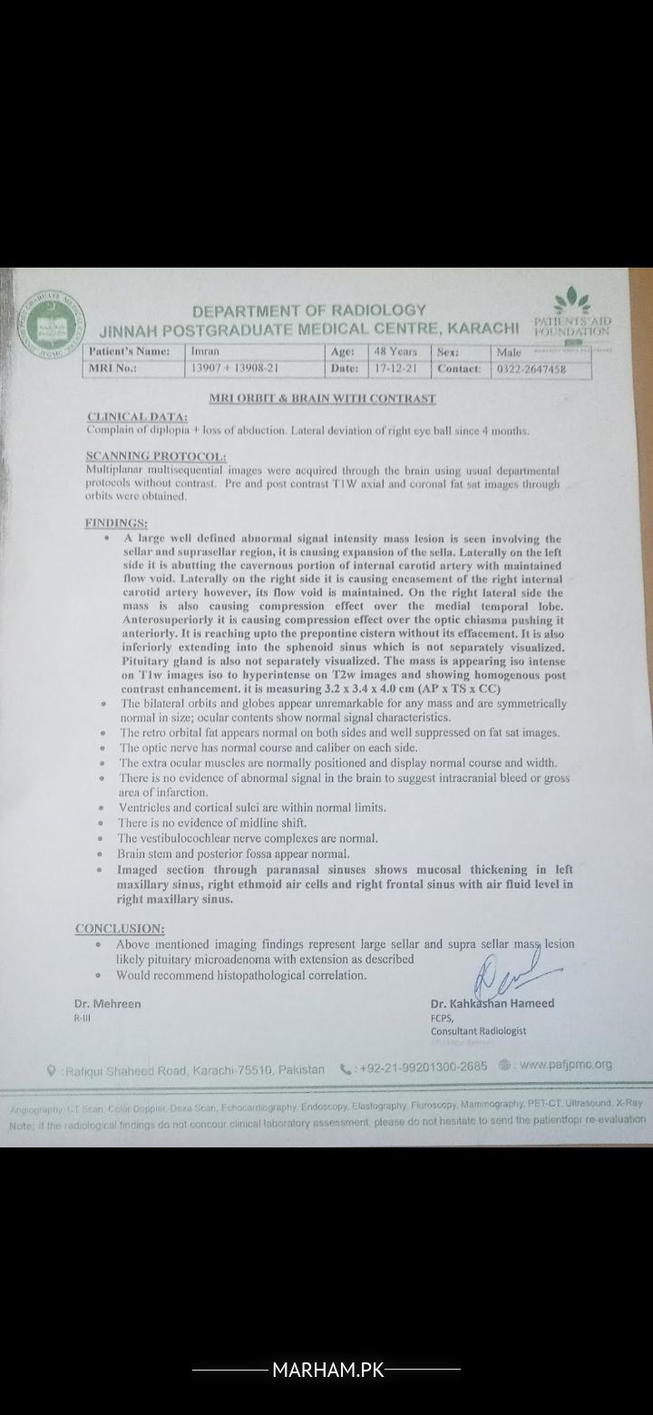 Ask a Ent Specialist Online for Microedema