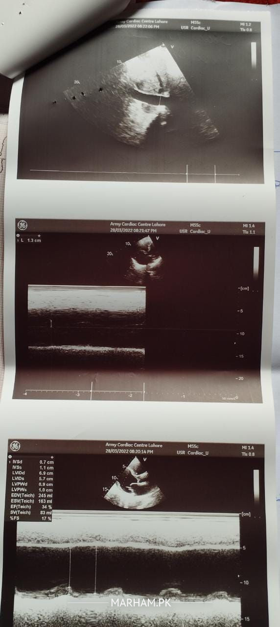 Ask a Cardiologist Online for Heart Week