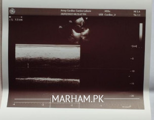 Ask a Cardiologist Online for Heart Week