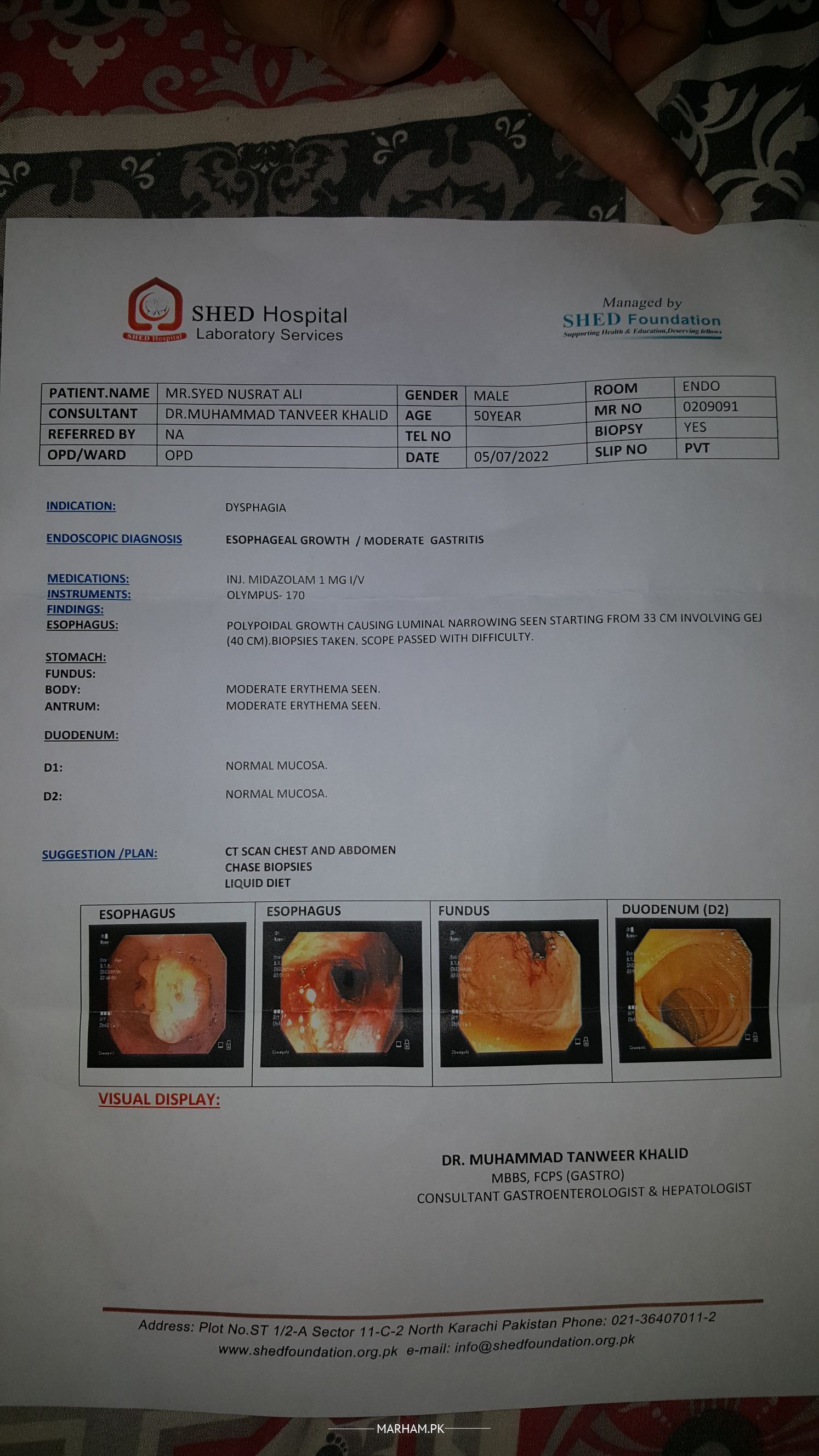 Ask a Gastroenterologist Online for Endoscopy Result