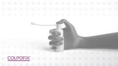 Cómo usar Colpofix®, el gel vaginal en spray contra el VPH