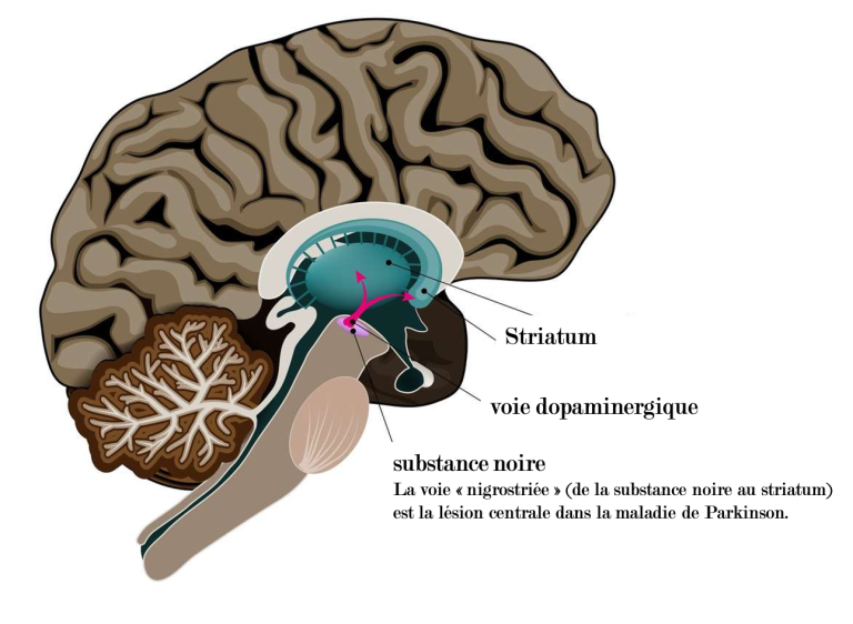 Maladie de Parkinson : la thérapie cellulaire progresse à grands pas ...