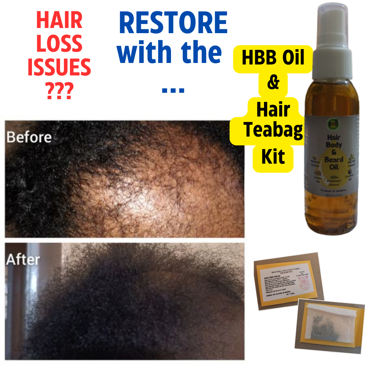 HBB Kit - Hair, Body & Beard Oil + Rosemary & Bay Leaves Teabag Kit ...