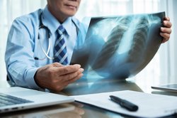 Pulmonary Doctor - Fall River, MA | Lung Doctor Near Me