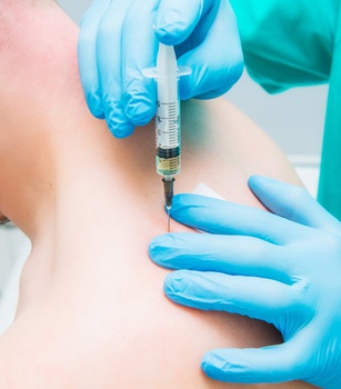 Trigger Point Injections | Myofascial Pain Treatment - Atlanta