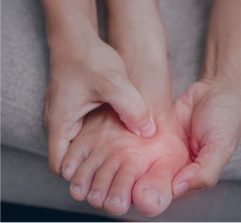 Foot Bunion Treatment In Austin, TX | Bunion Surgery Near Me