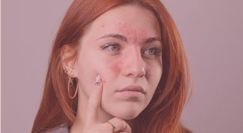 Exosome Skin Treatment In Denver | Exosomes Treatment Near Me