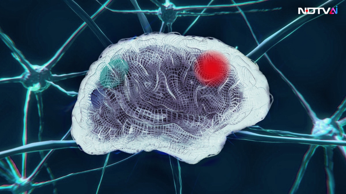 Particle News: AI Tool FastGlioma Revolutionizes Brain Tumor Surgery