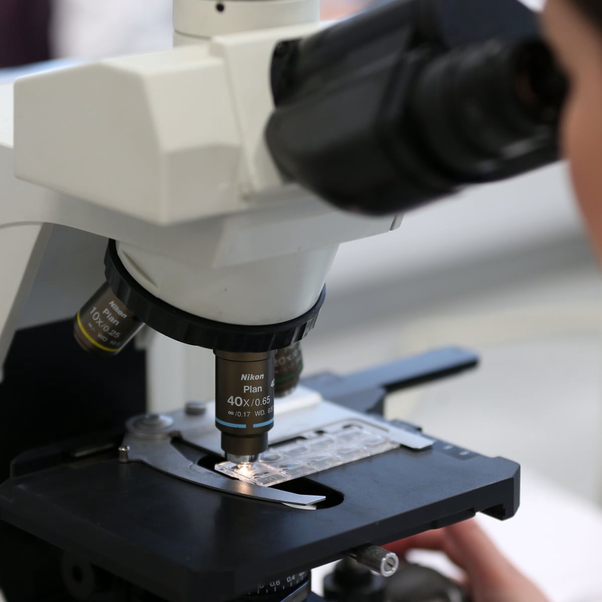 Particle News: New Swab Test for Womb Cancer Approved in the UK