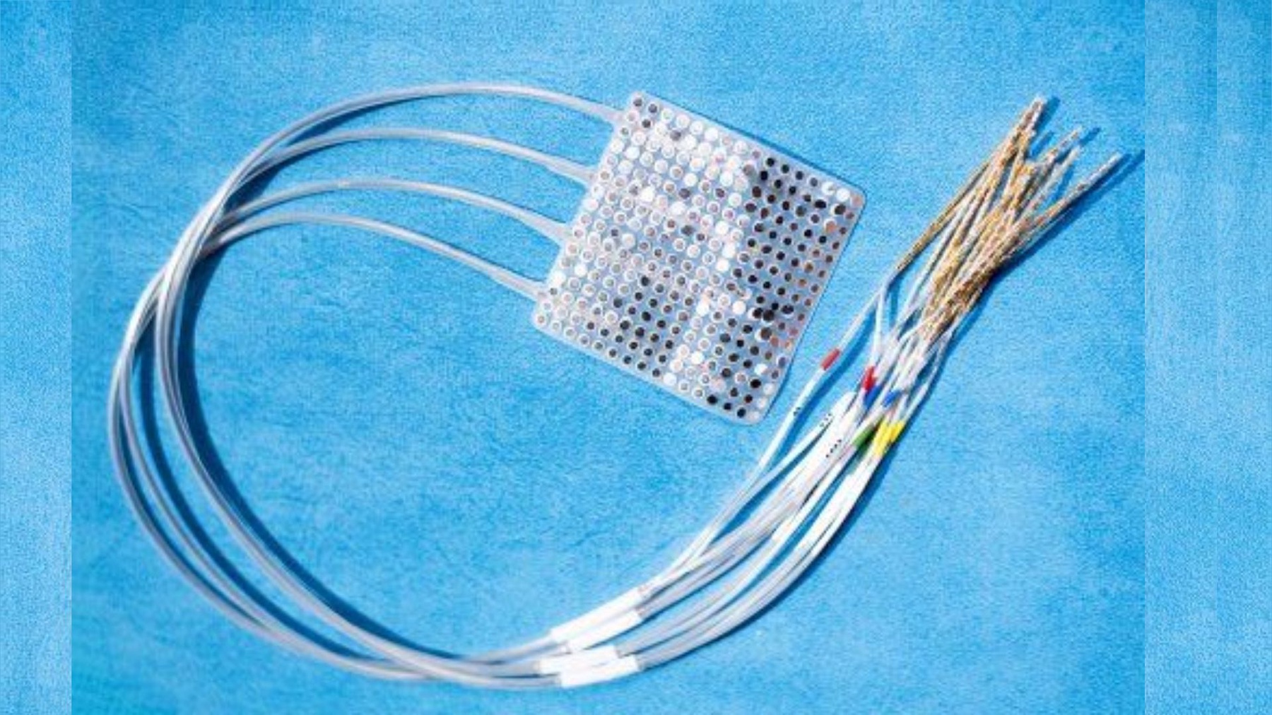 Particle News: Paralyzed Man Controls Robotic Arm for Record Seven Months Using AI Brain Implant