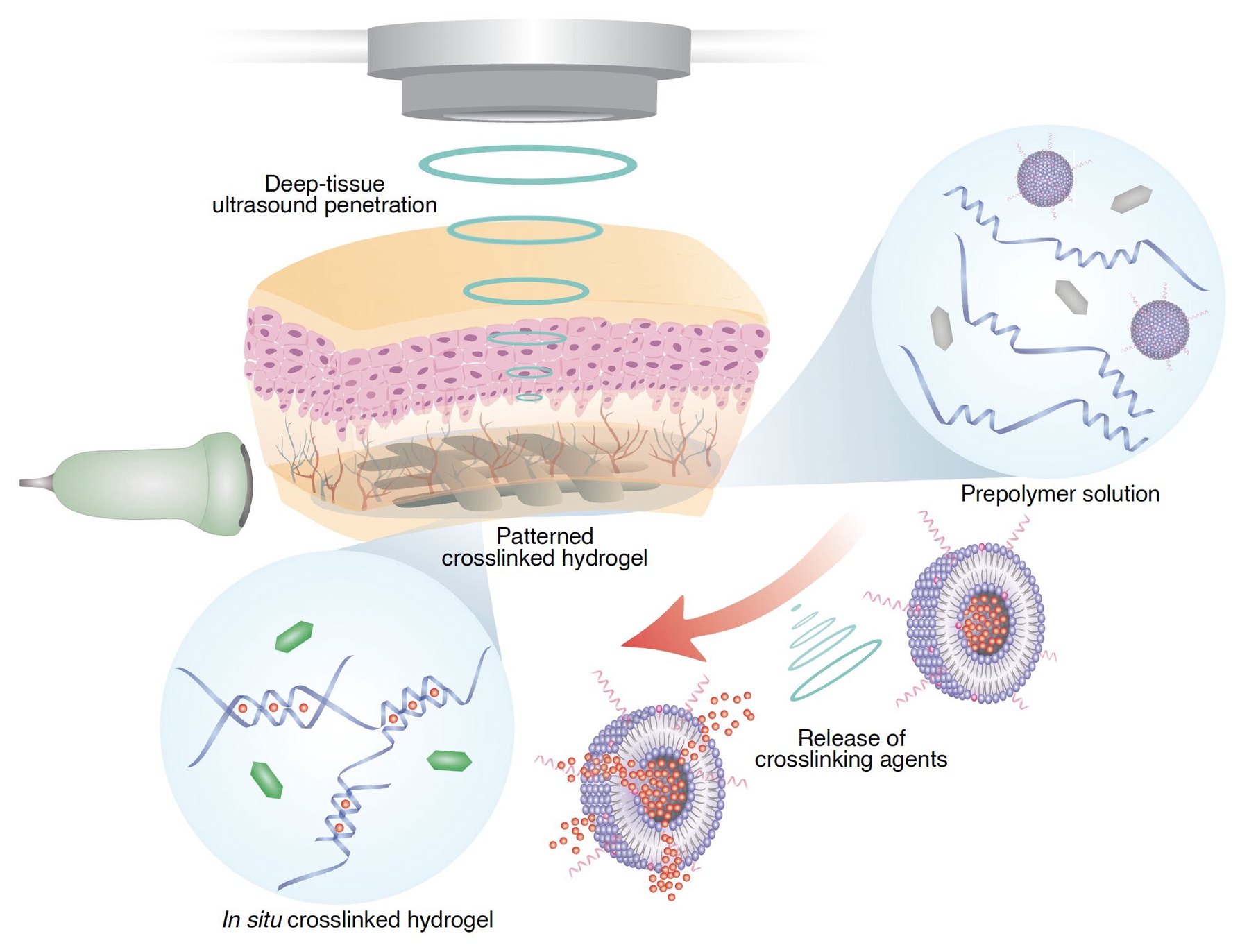Particle News: Caltech-Led Team Develops Ultrasound-Guided In Vivo 3D ...