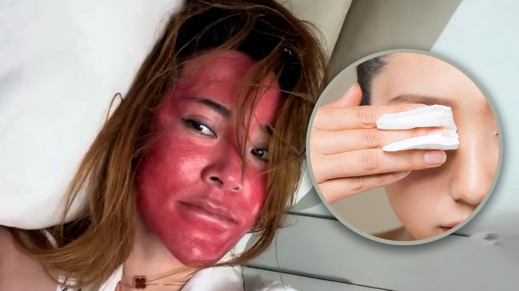 Particle: Chinese Influencer’s 22-Year Makeup Habit Leaves Her Face ...