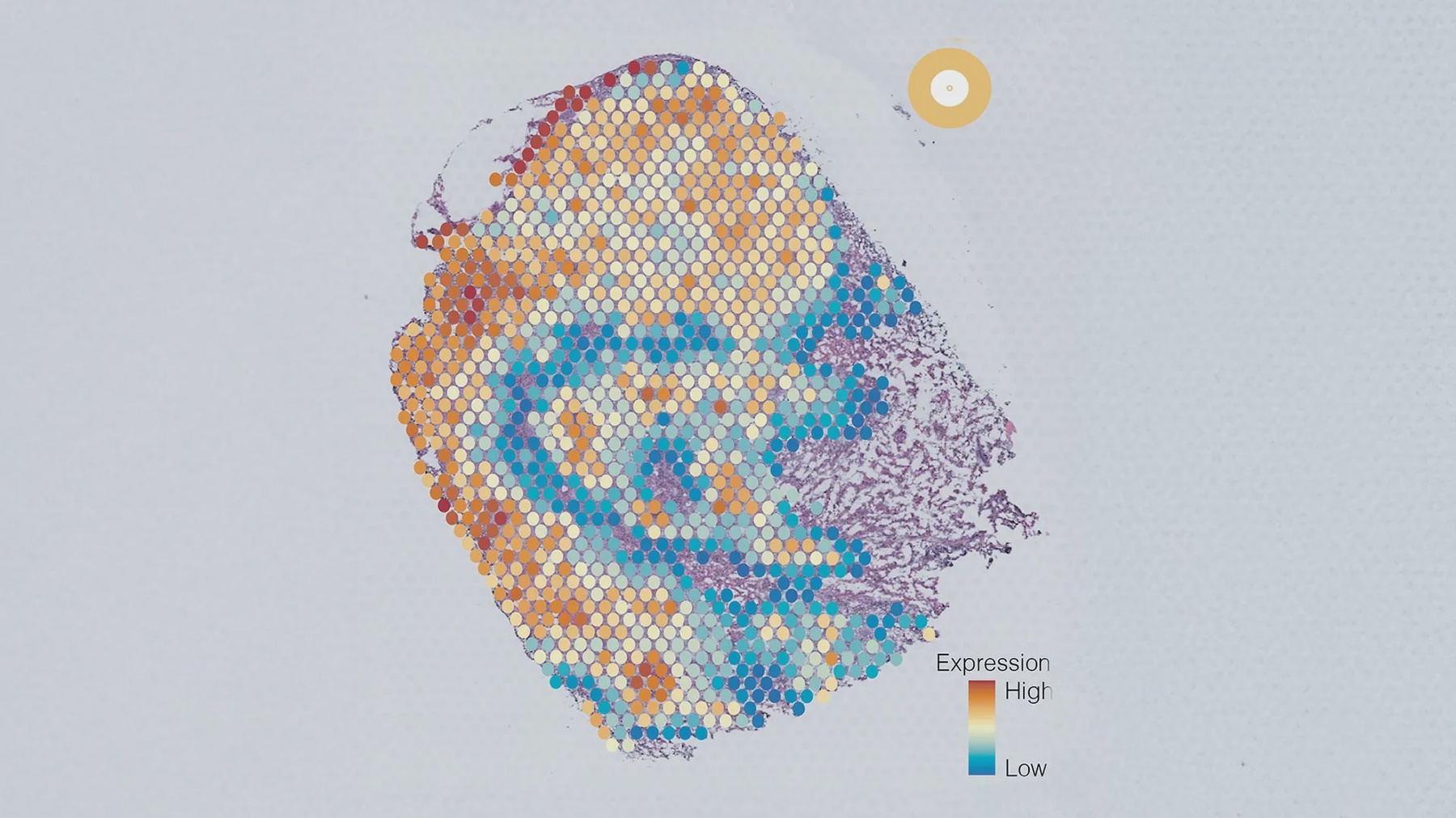 Particle: AAnet AI Framework Reveals Five Cancer Cell Archetypes