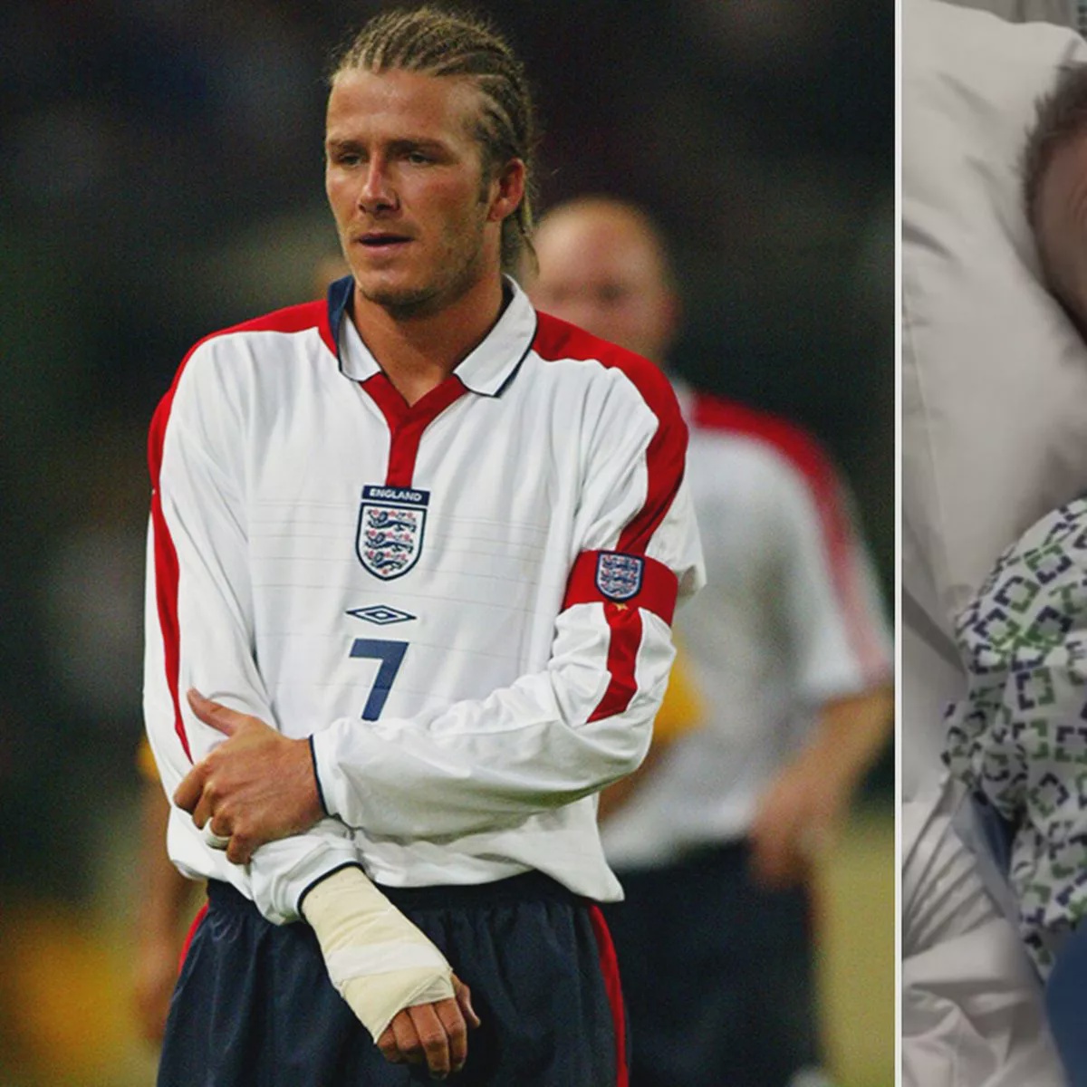 Particle News: David Beckham Recovers After Surgery to Address Decades ...
