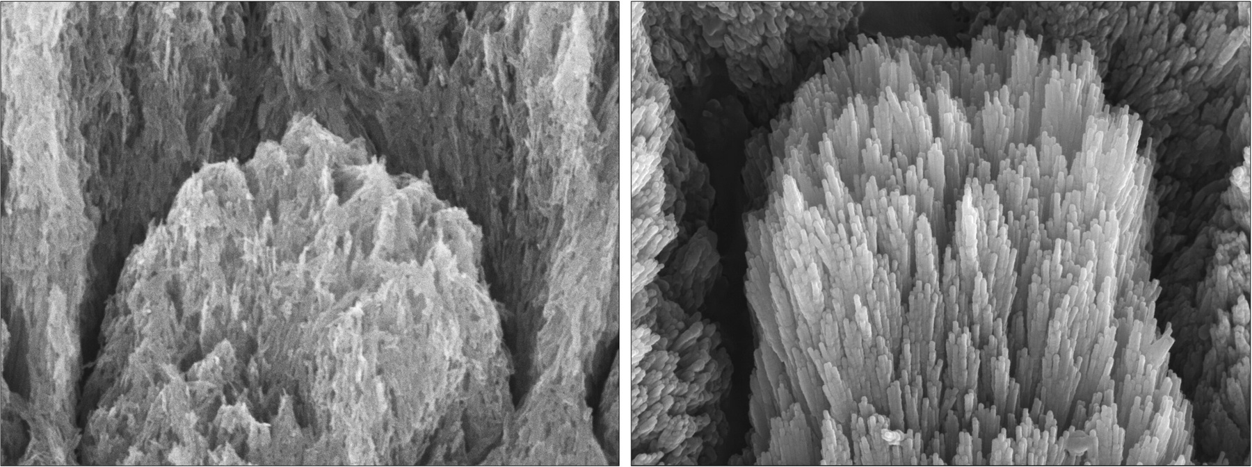Particle: Fluoride-Free Protein Gel Regrows Enamel in Lab Tests, Paving ...