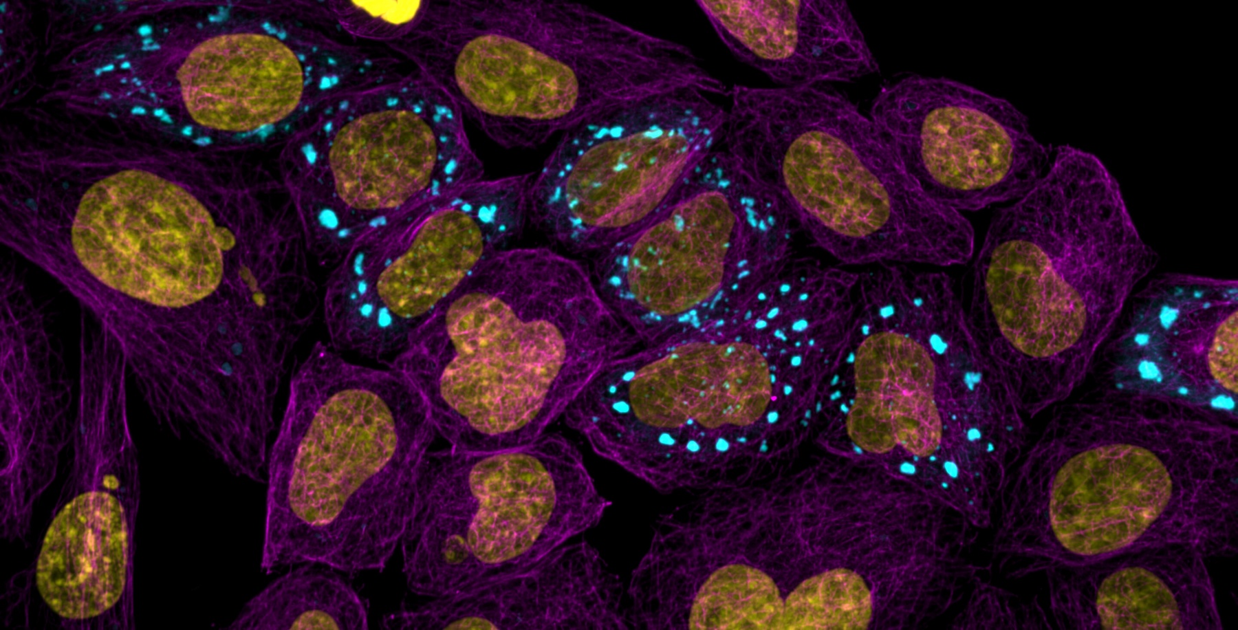 Particle: Cambridge Scientists Create AI-Powered Atlas Mapping Protein ...