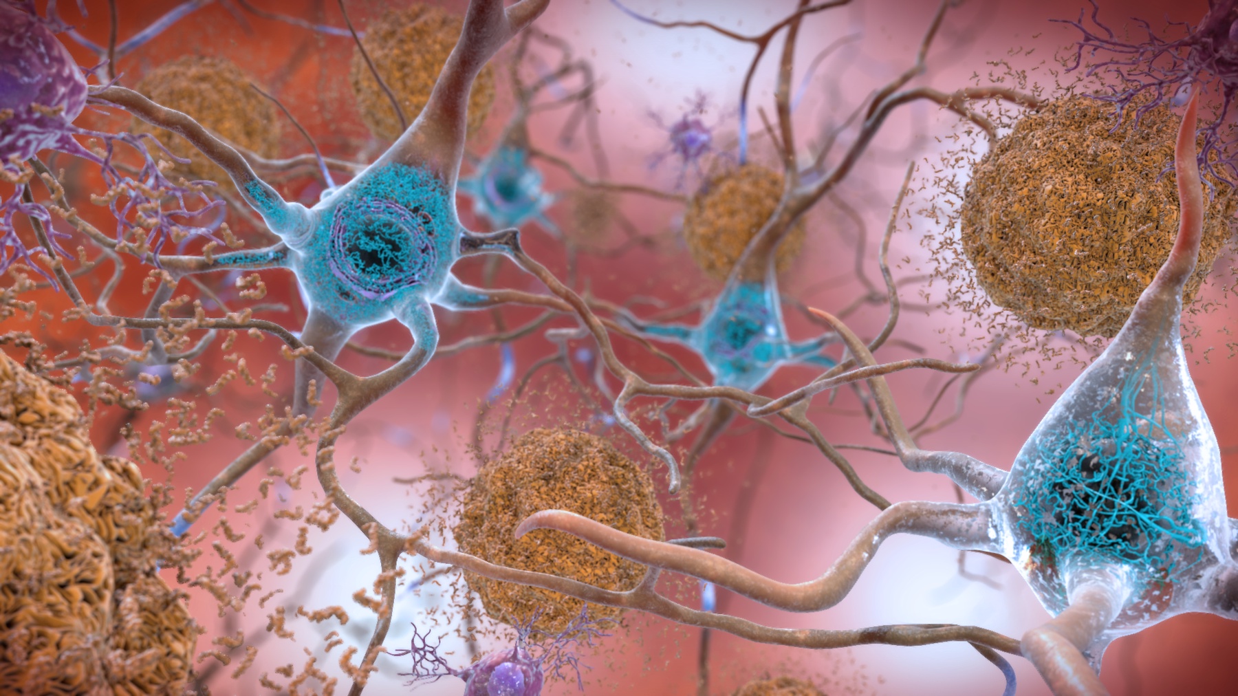 Particle News: Scientists Unveil Molecular Structures of Alzheimer's ...