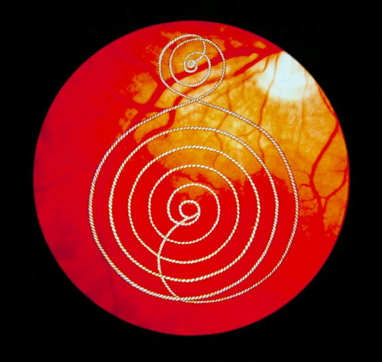 Rob Flack: This Is True To Me | Visual AIDS