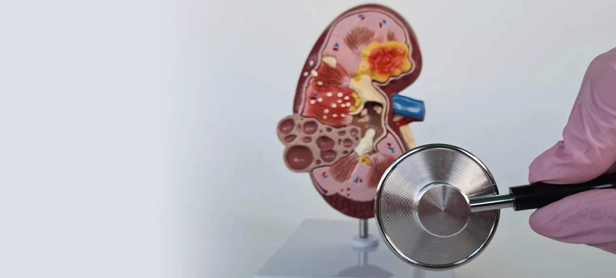 Signs you should get screened for Kidney Cancer