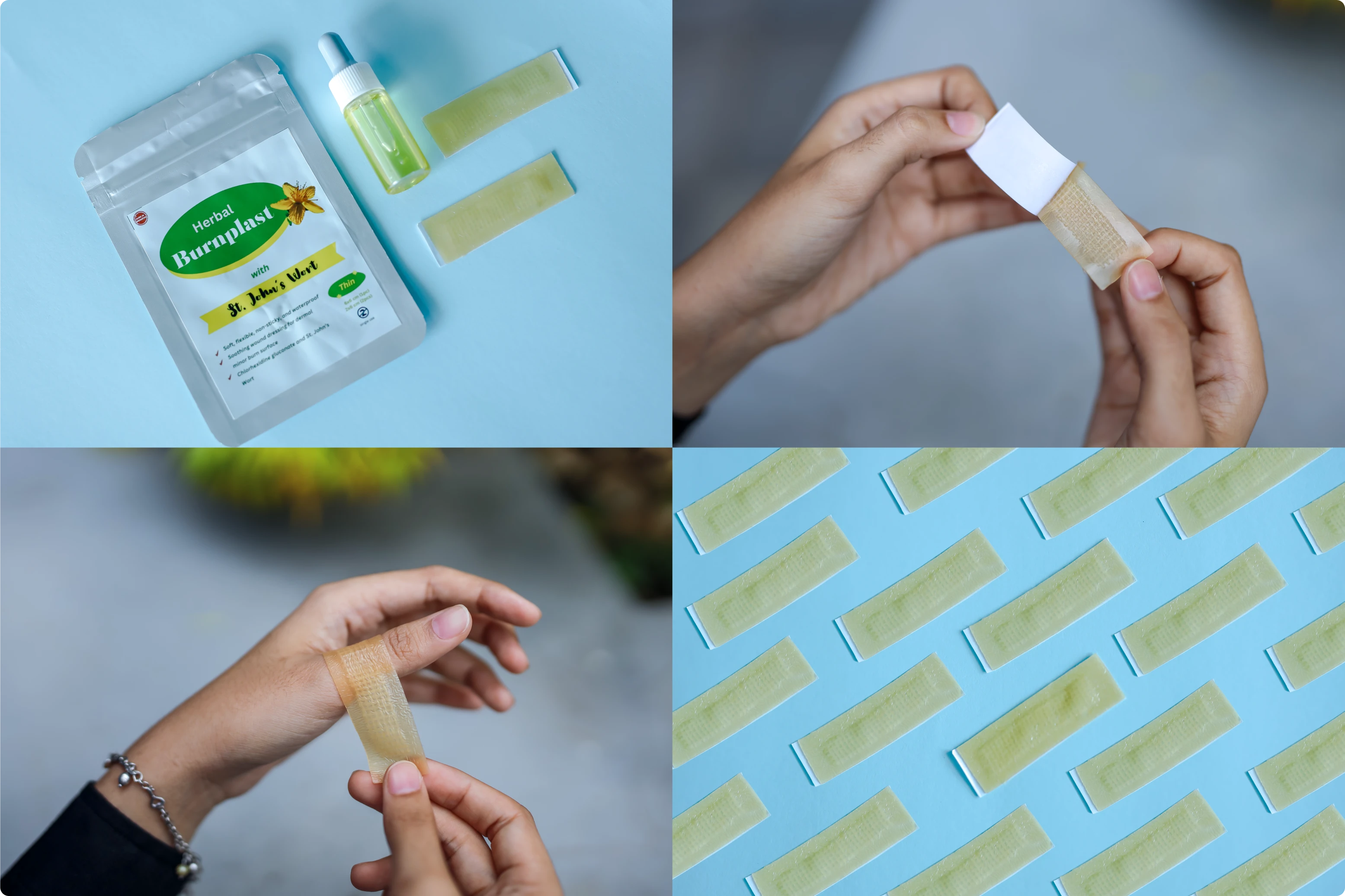 Inovasi Plester Hidrokoloid, Angin Segar Pertolongan Pertama Luka Bakar ...