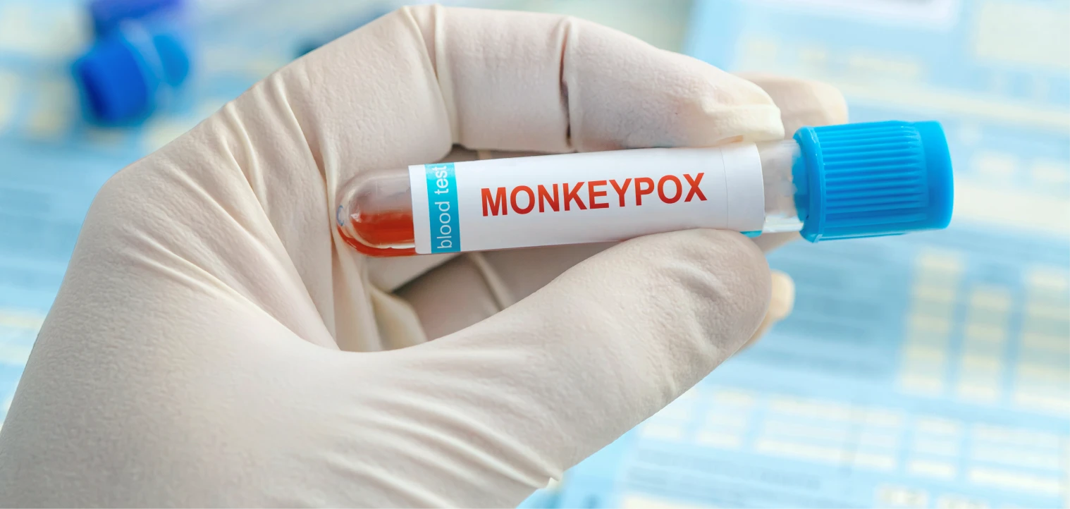 Mengenal Monkeypox, Penularan, dan Pencegahannya | Universitas ...