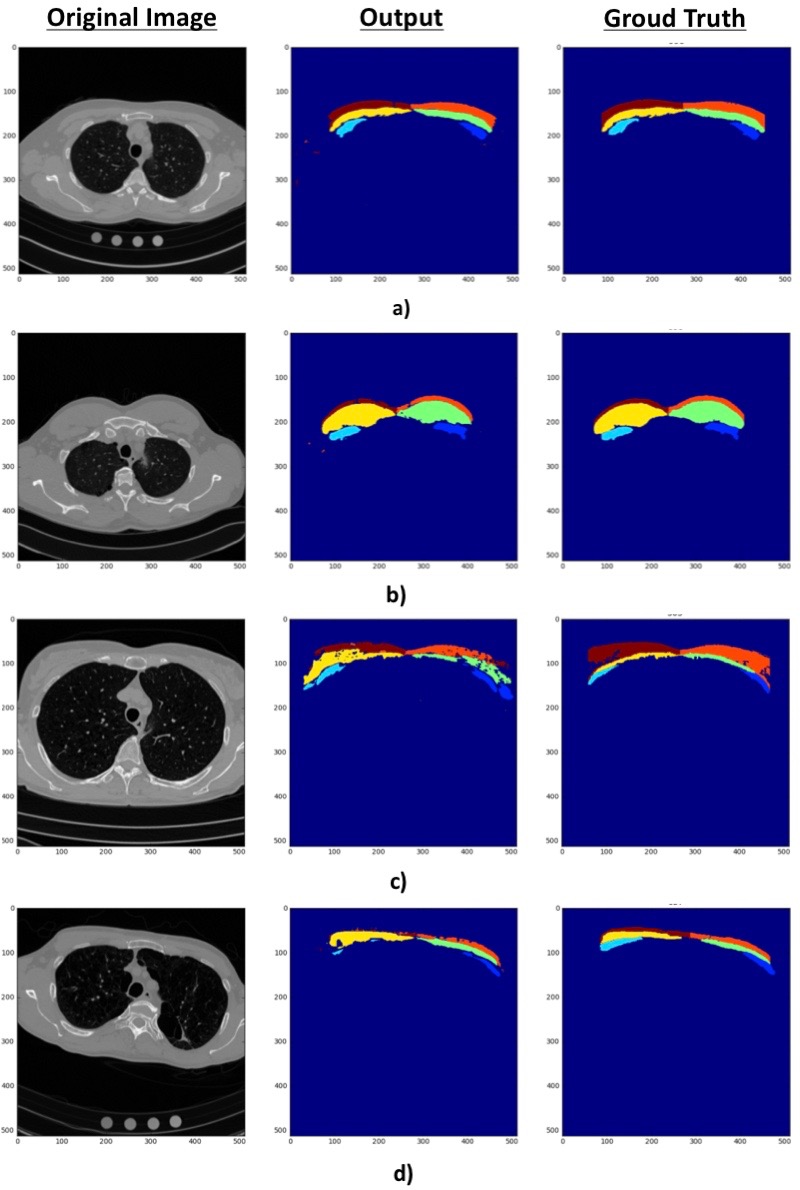 Deep Learning in Medical Imaging – IGT Research Group