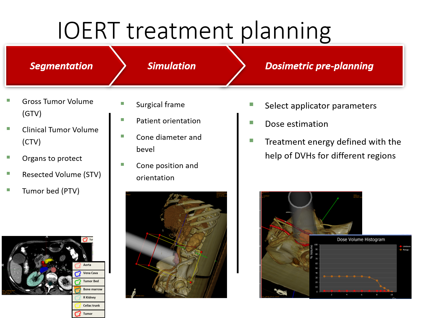 Intraoperative Electron Radiation Therapy – IGT Research Group
