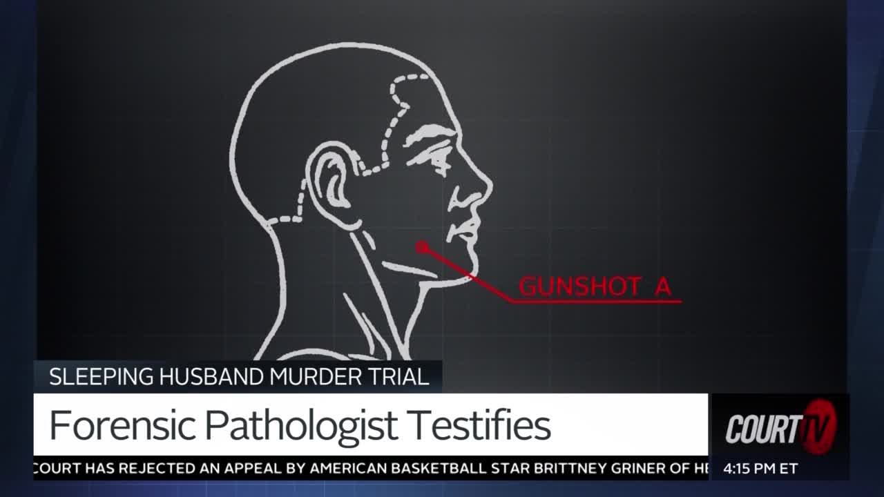 Sleeping Husband Murder Trial: Forensic Pathologist Testifies | Court ...