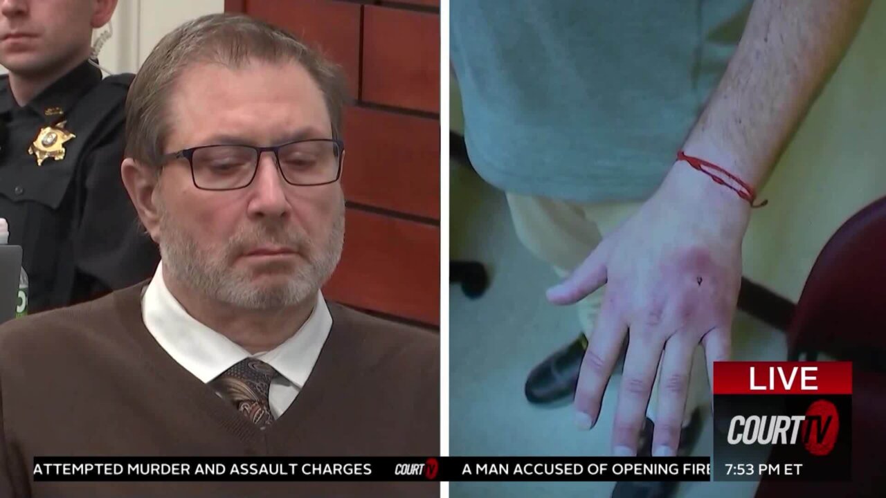 Paul Caneiro's Injured Hands Shown To Jury | Court TV Video