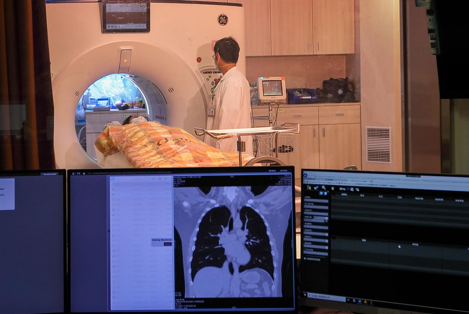 發現肺結節要馬上開刀？肺癌名醫與它共存20年｜天下雜誌